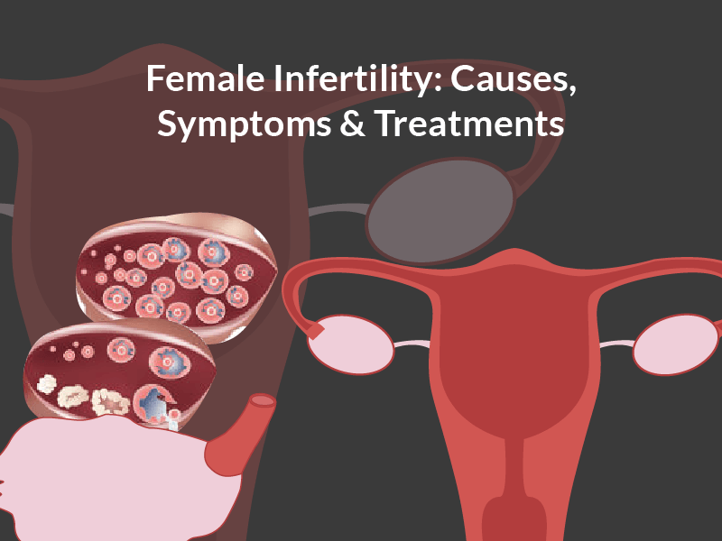 Female Infertility Causes Symptoms Treatments